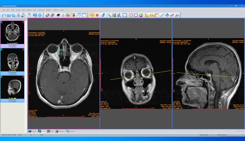Sante DICOM Editor 10.3 Full Version Free Download - FileCR